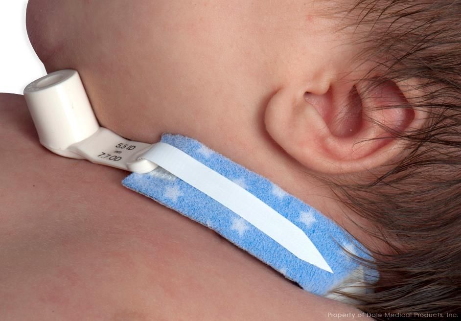 PediPrints 2-Piece Tracheostomy Tube Holder Fits up to 9in Neck 10Ct