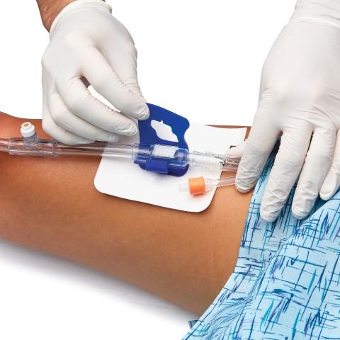 SafeSecure Foley Catheter Securement Device